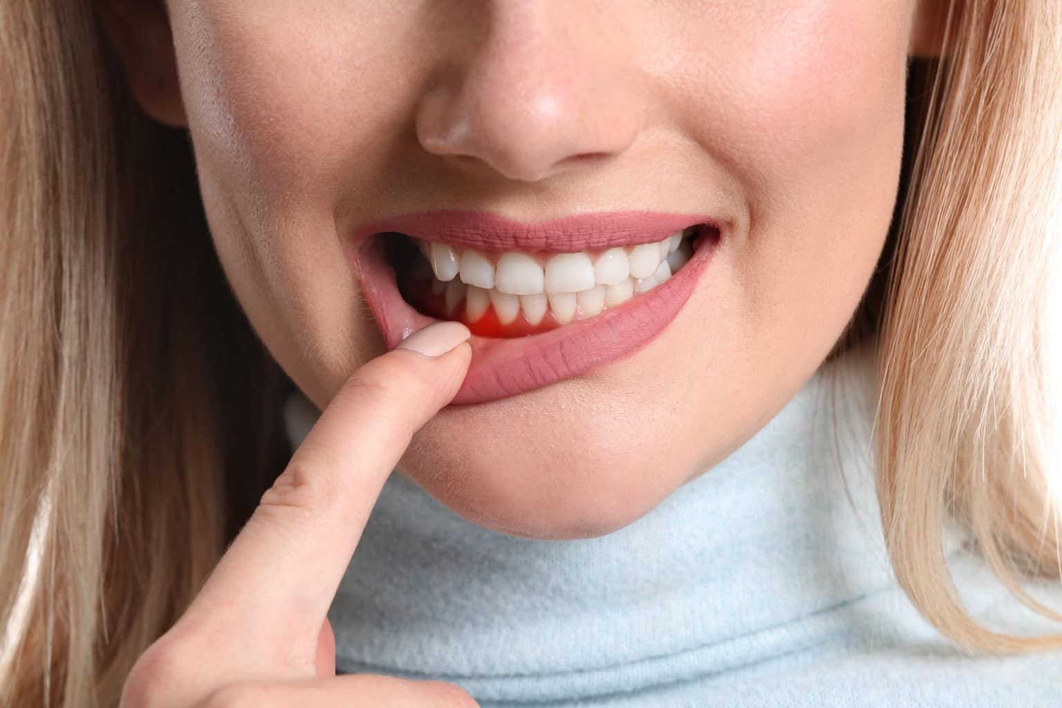 Gingivitis: Symptoms and Causes in California - NoHo Family Dental